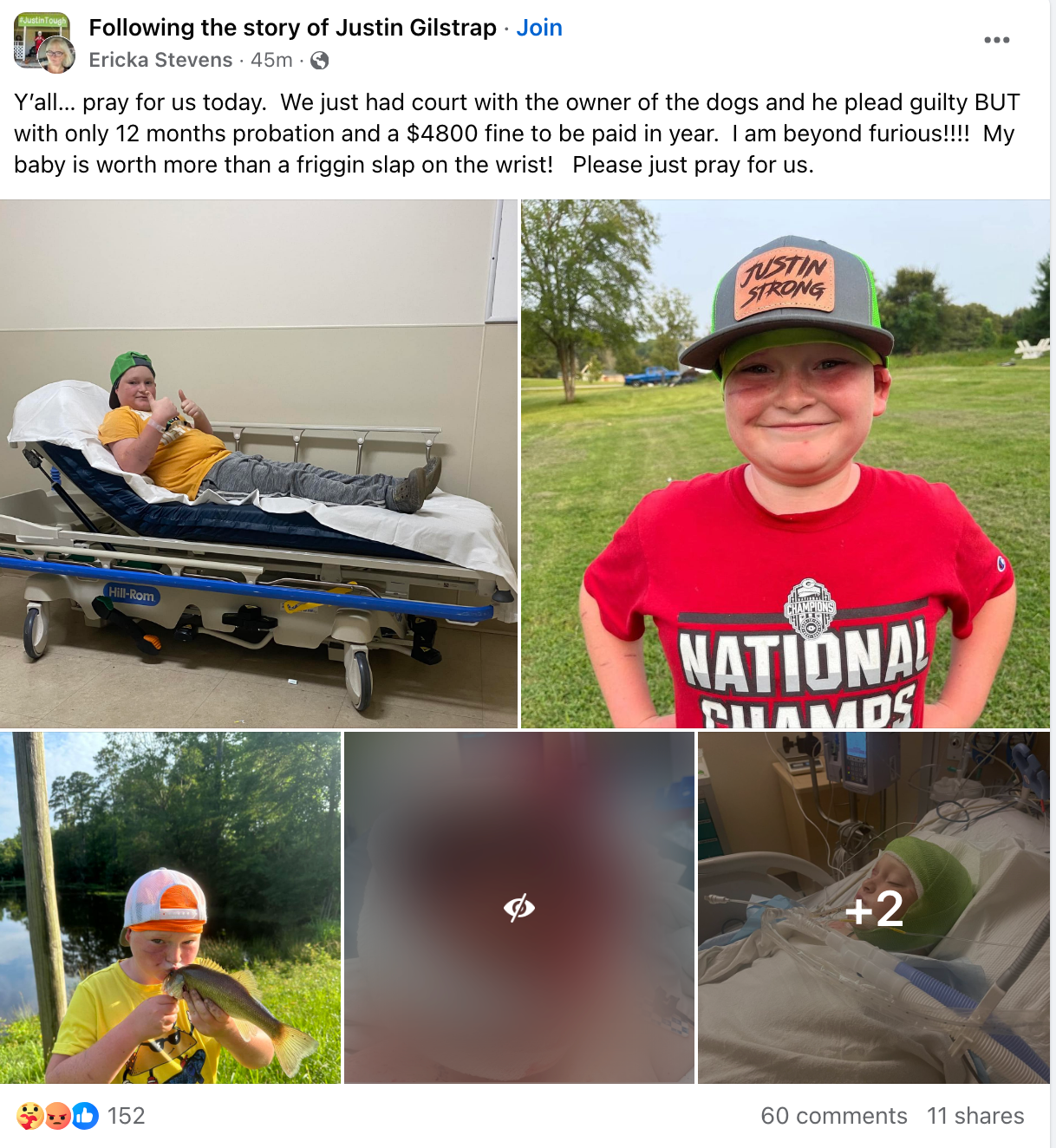 Judge gives probation to dog owner in pit bull attack on Justin ...